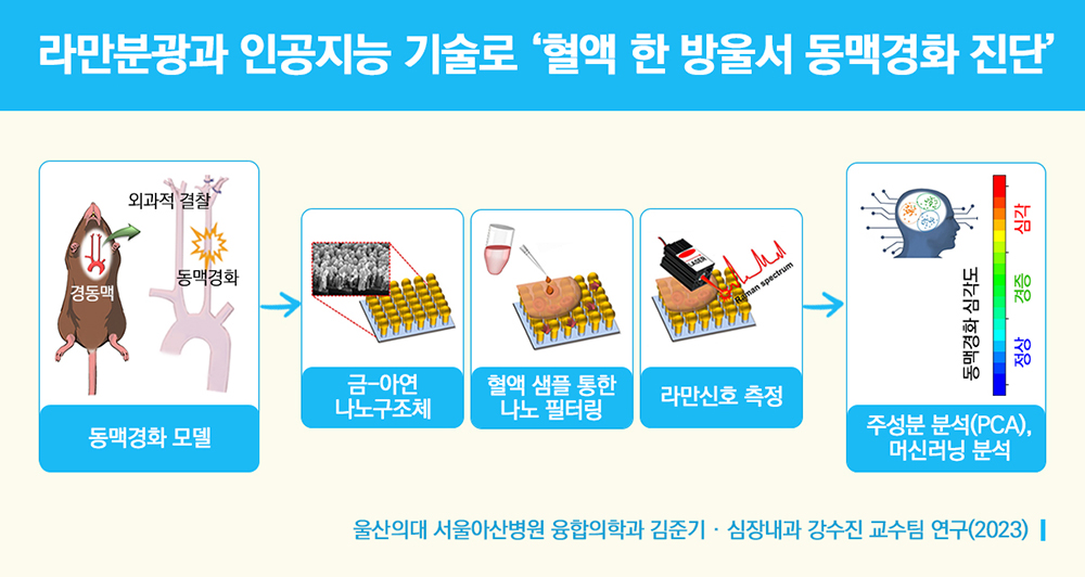 라만분광·인공지능 기술로 혈액 한 방울서 동맥경화 진단 보도자료 프레스센터 서울아산병원 뉴스룸